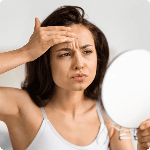 Best Skin Clinic in Hyderabad | Skin Specialist in Hyderabad | Dermiq ...